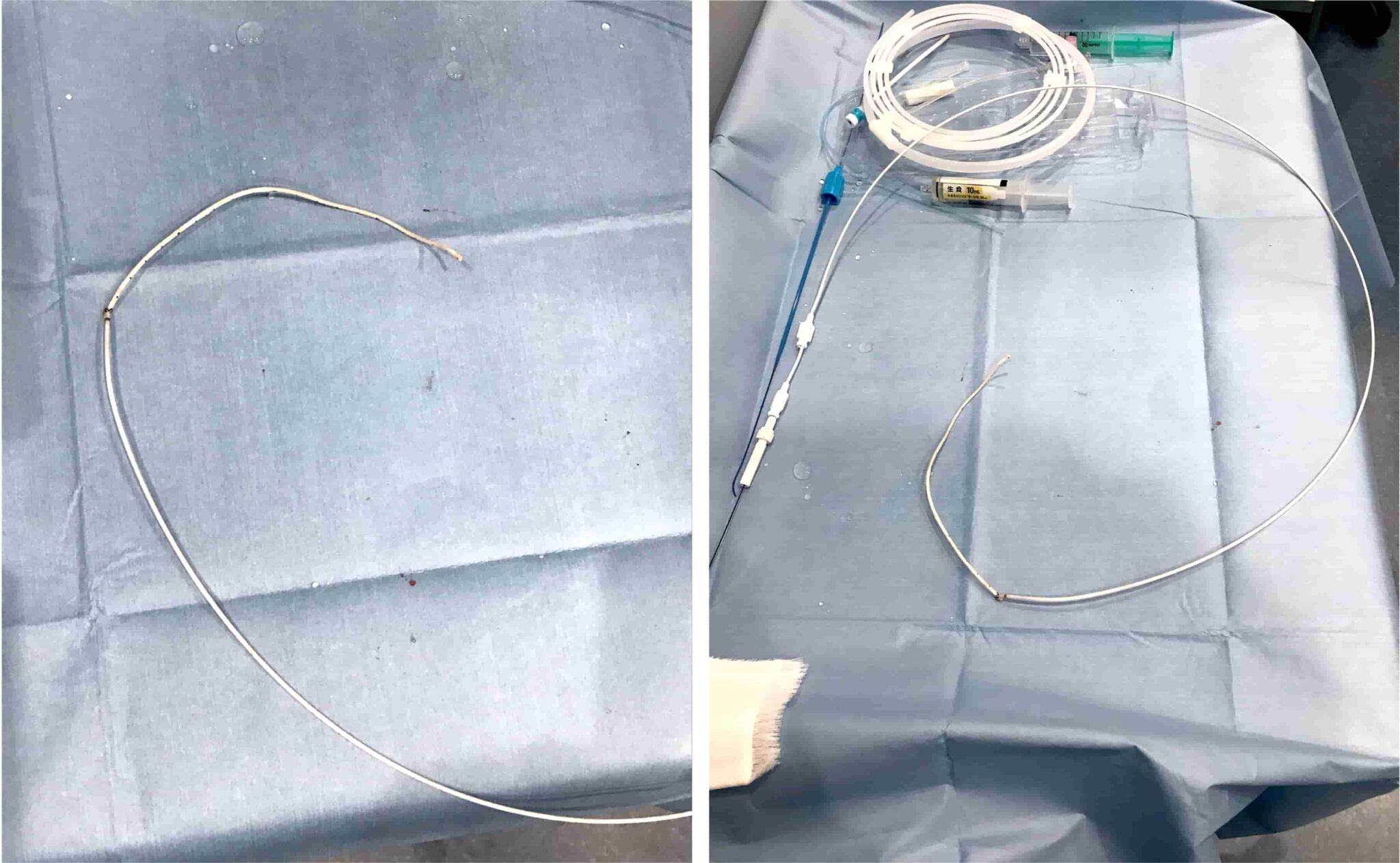 CVポート：VADセンター - AMS きしクリニック札幌